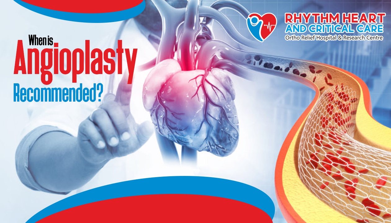 When is Angioplasty Recommended? - Rhythm Hospital